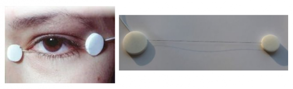 Electrodes for Clinical Practice - Diagnosys LLC