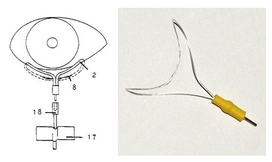 Electrodes for Clinical Practice | Diagnosys LLC
