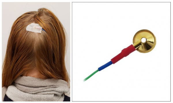 Electrodes for Clinical Practice - Diagnosys LLC