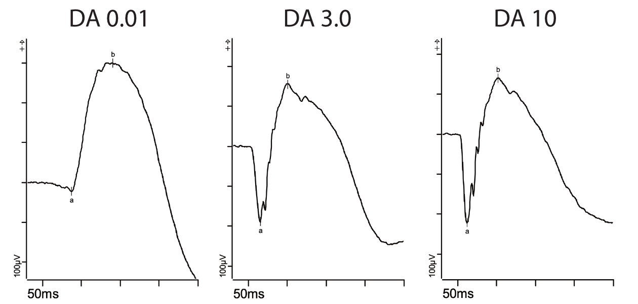 Full-field Electroretinography (ERG) - Diagnosys LLC