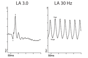 Full-field Electroretinography (ERG) - Diagnosys LLC