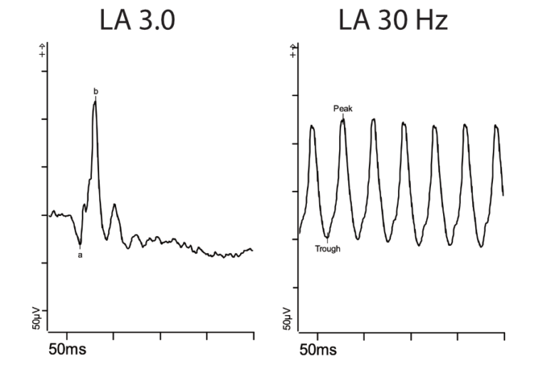 Full-field Electroretinography (ERG) - Diagnosys LLC