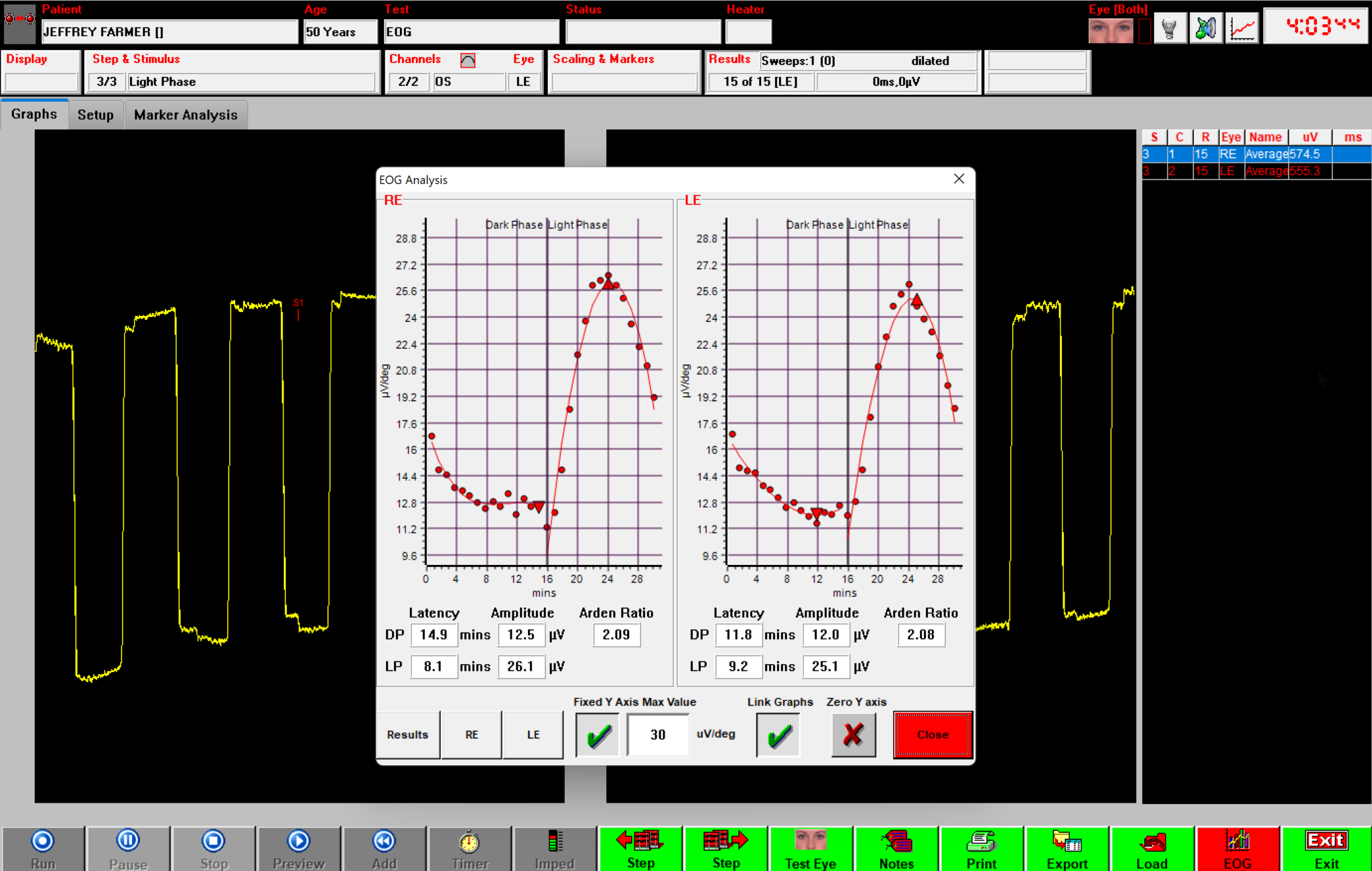 Electrooculography (EOG) - Diagnosys LLC