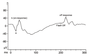 Full-field Electroretinography (ERG) - Diagnosys LLC