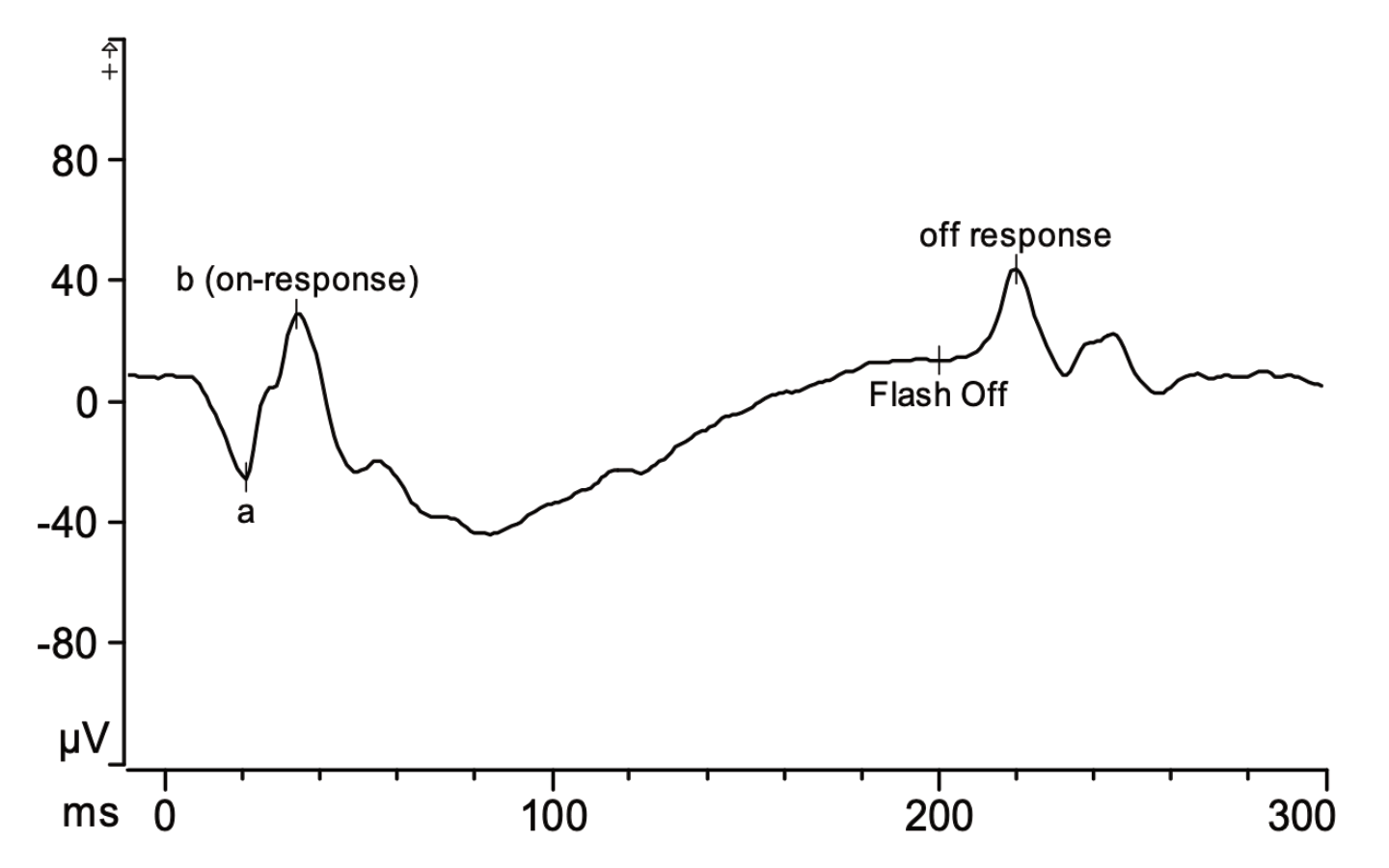 Full-field Electroretinography (ERG) - Diagnosys LLC