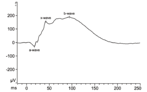 Full-field Electroretinography (ERG) - Diagnosys LLC