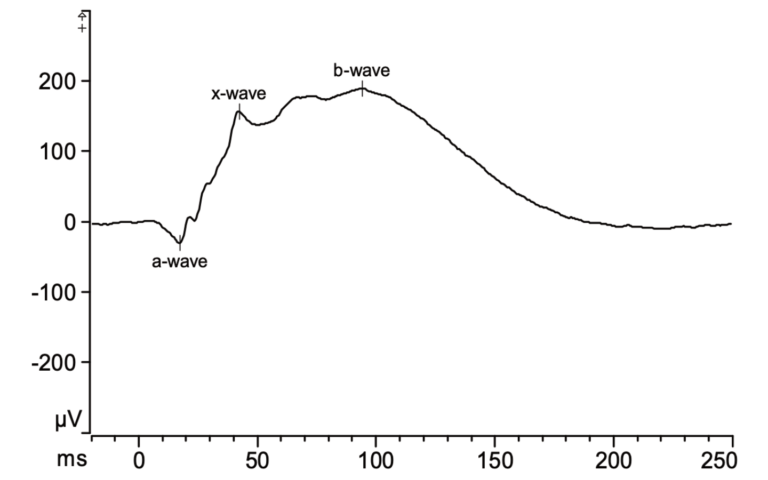 Full-field Electroretinography (ERG) - Diagnosys LLC