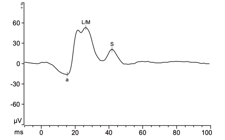 Full-field Electroretinography (ERG) - Diagnosys LLC