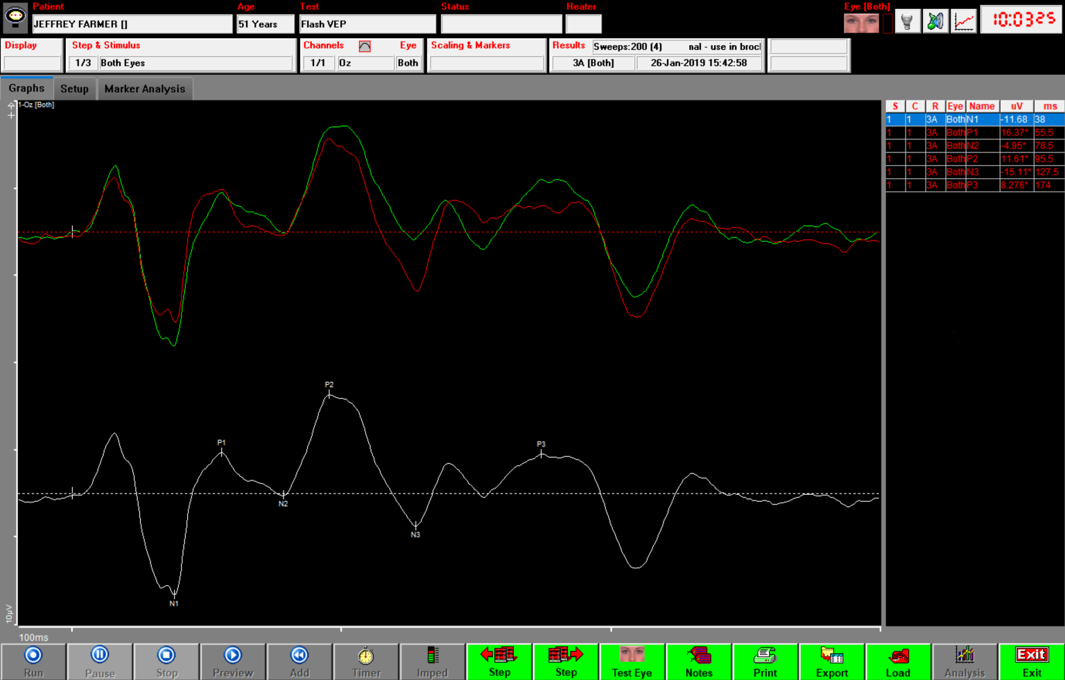 Visually Evoked Potentials (VEP) - Diagnosys LLC