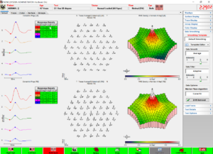 Multifocal Electroretinography (mfERG) - Diagnosys LLC