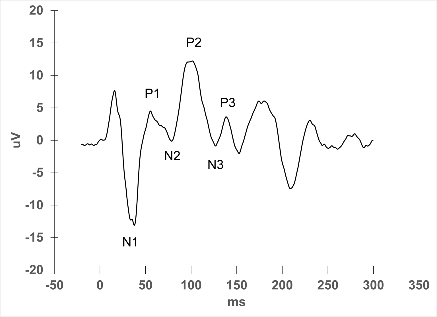Visually Evoked Potentials (VEP) - Diagnosys LLC