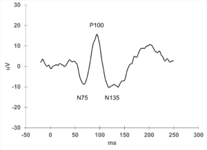 Visually Evoked Potentials (VEP) - Diagnosys LLC